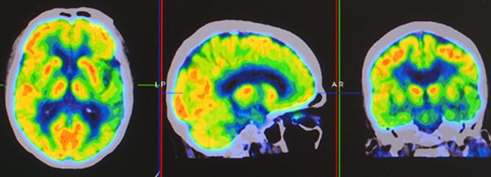 X — The Ultimate Brain Performance Enhancer